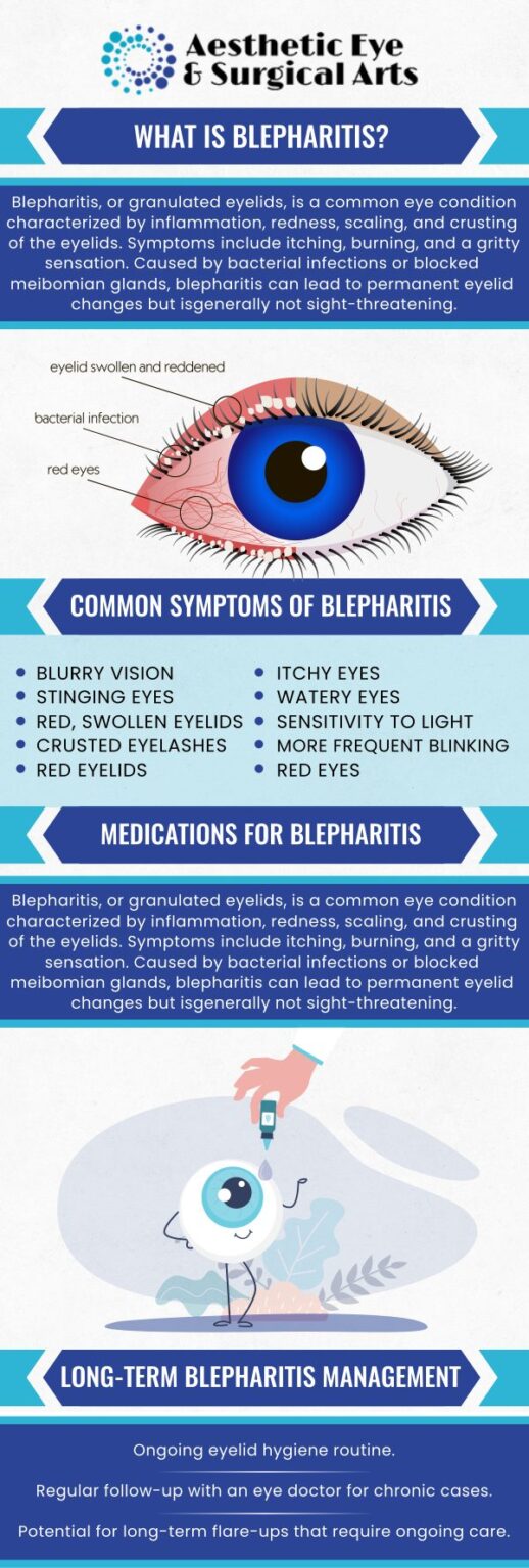 Recognizing the Early Signs and Symptoms of Blepharitis